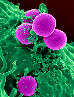 What is MRSA?